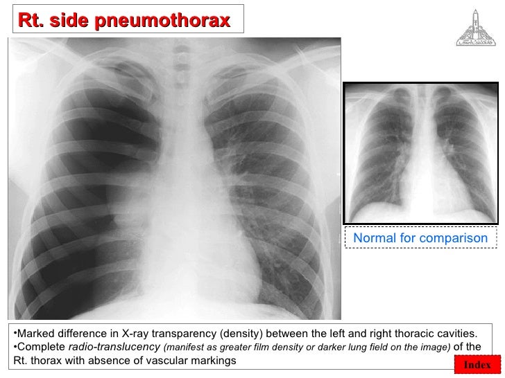 Chest surgical pathology &x rays
