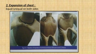 Chest Symmetry & Chest Expansion.pptx... | PPTX