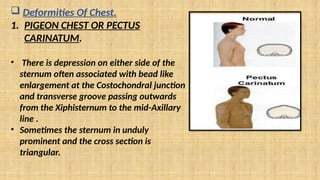 Chest Symmetry & Chest Expansion.pptx... | PPTX