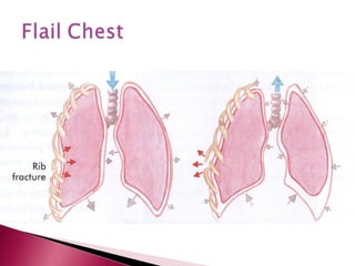 Chest test presentation | PPT