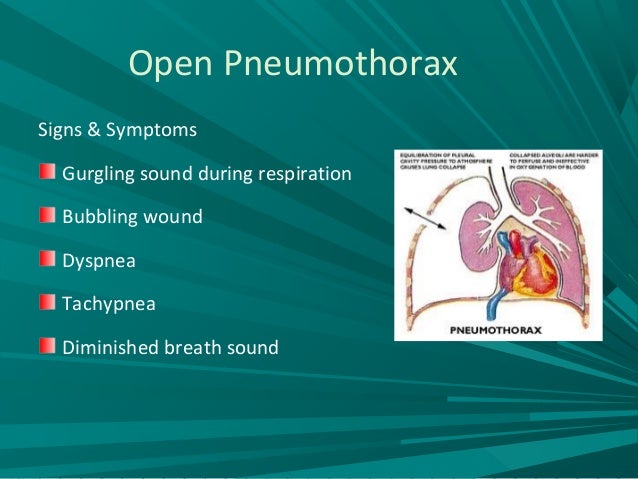 Open Pneumothorax Signs And Symptoms