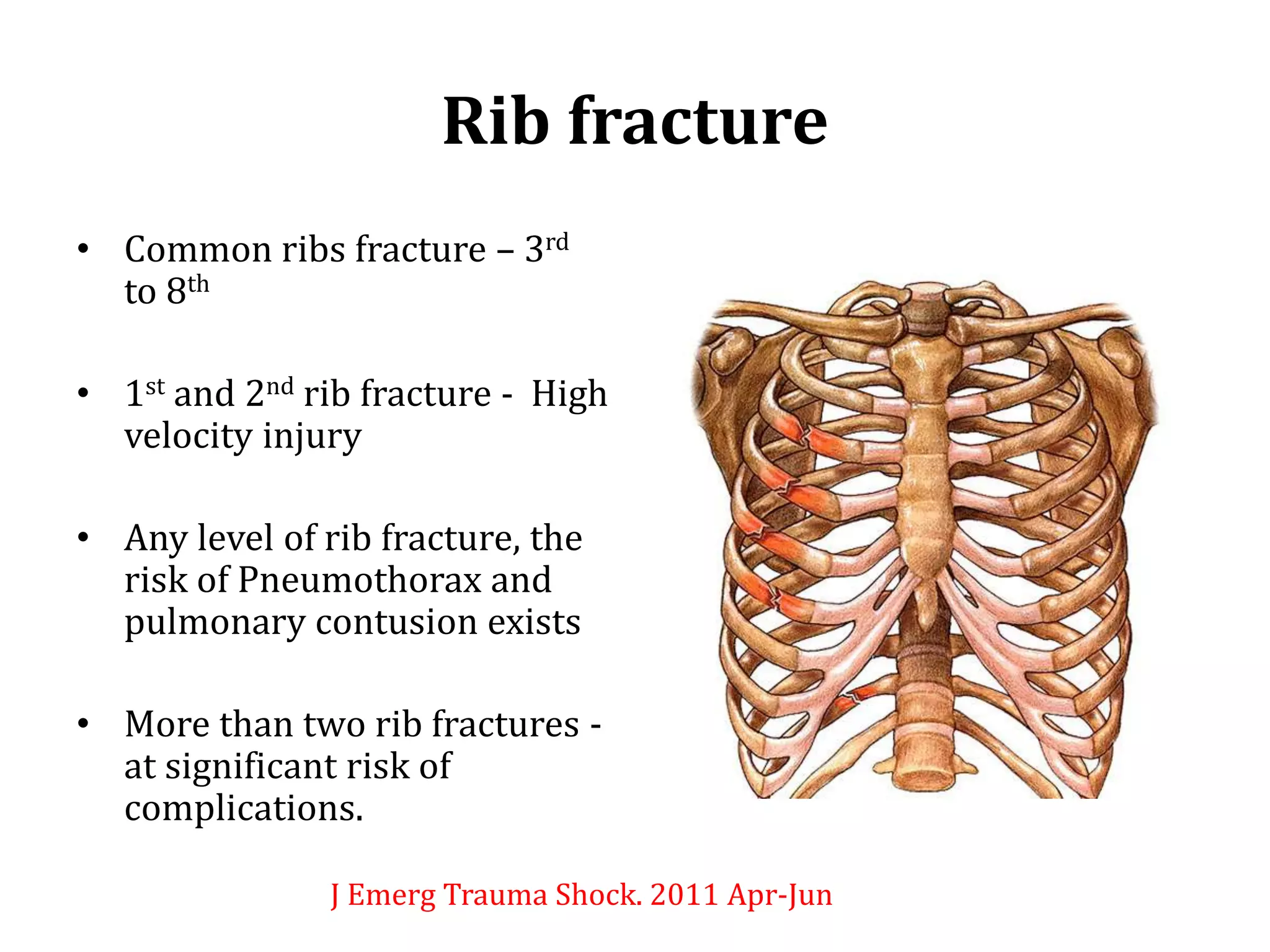 Chest trauma | PPTX