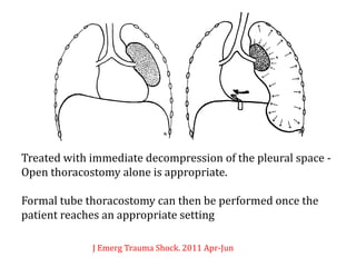 Chest trauma | PPTX