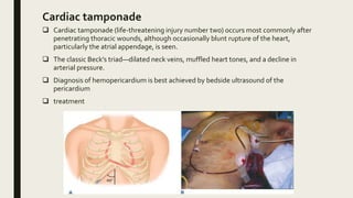 Chest trauma | PPTX