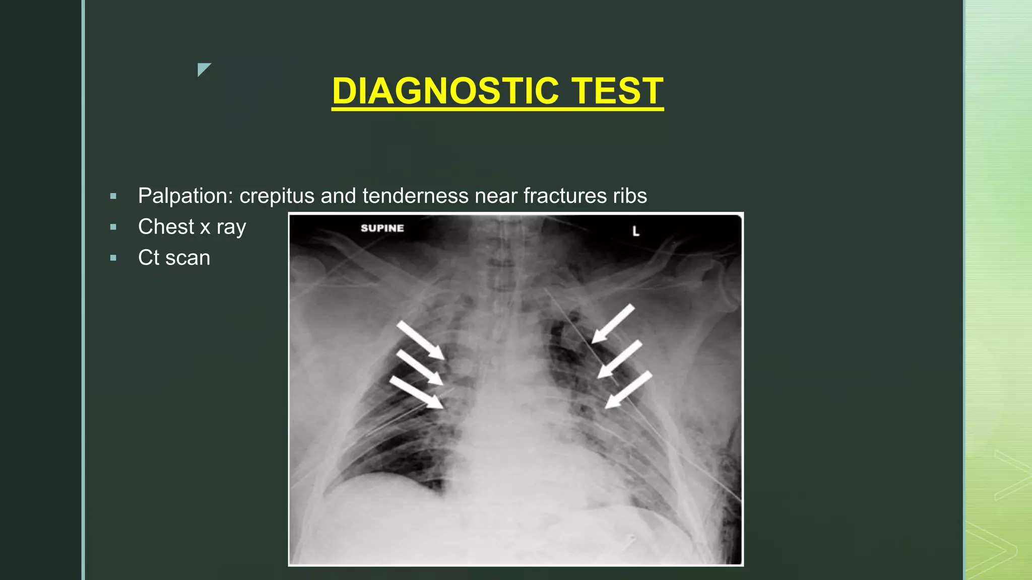 Chest trauma | PPTX