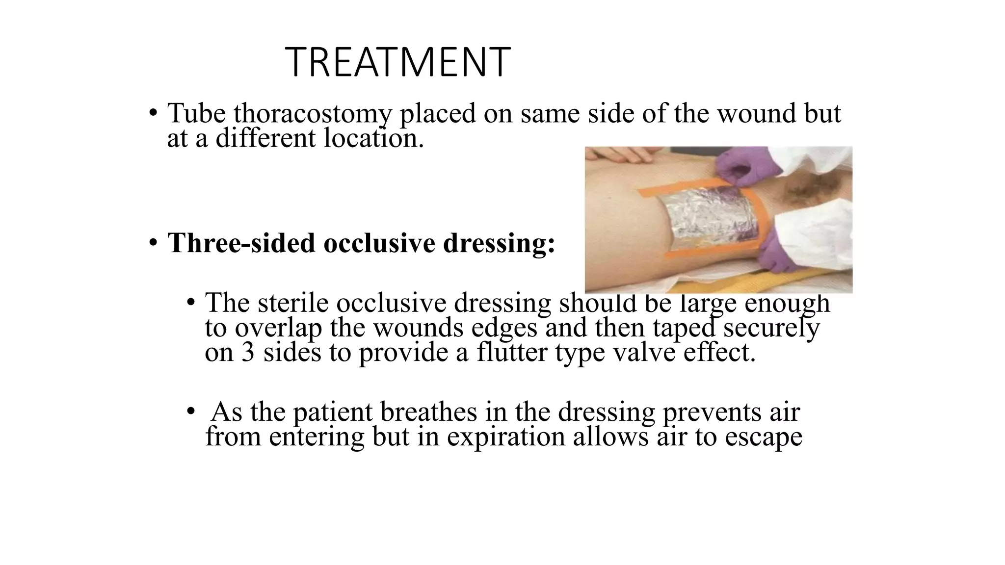 Chest trauma | PPTX