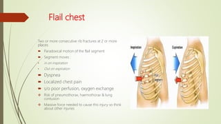 Chest trauma | PPTX