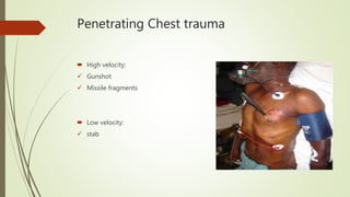 Chest trauma | PPT