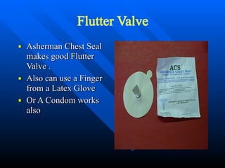 Chest trauma | PDF