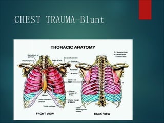 chest trauma.pdf