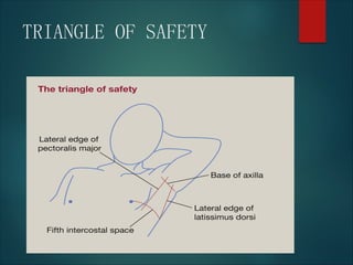chest trauma.pdf