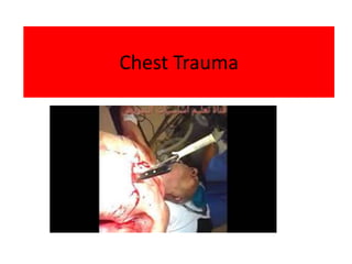 chest trauma.pptx