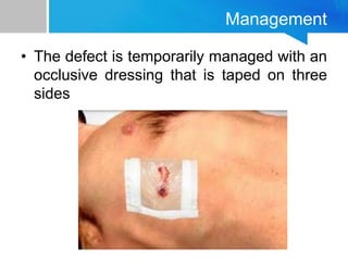 chest trauma | PPT