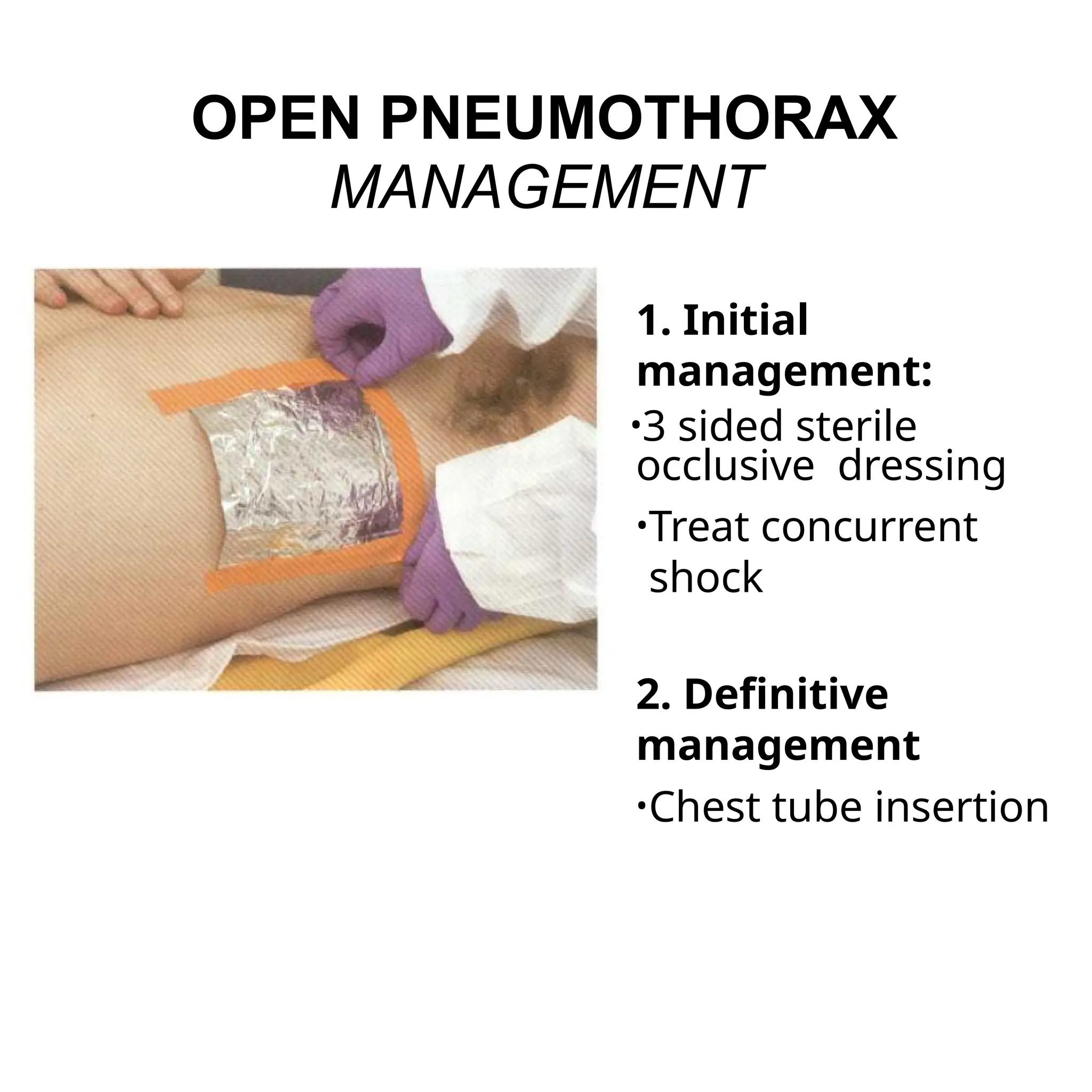 chest trauma Critical Care topic for medical | PPTX