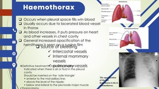CHEST TRAUMA and Thoracic outlet syndrome- AMRAN UN.pptx