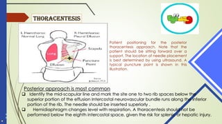 CHEST TRAUMA and Thoracic outlet syndrome- AMRAN UN.pptx