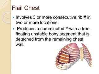 Chest trauma | PPTX