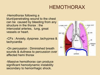 Chest trauma | PPTX