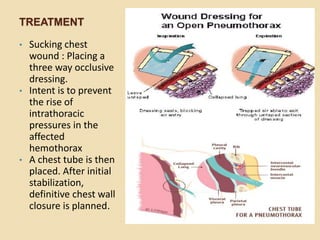 Open Pneumothorax Dressing