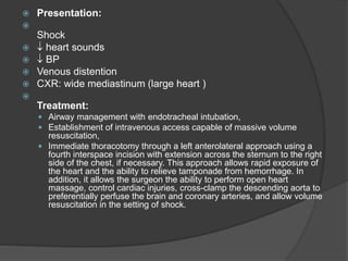 Chest Trauma (2).pptx.................... | PPTX