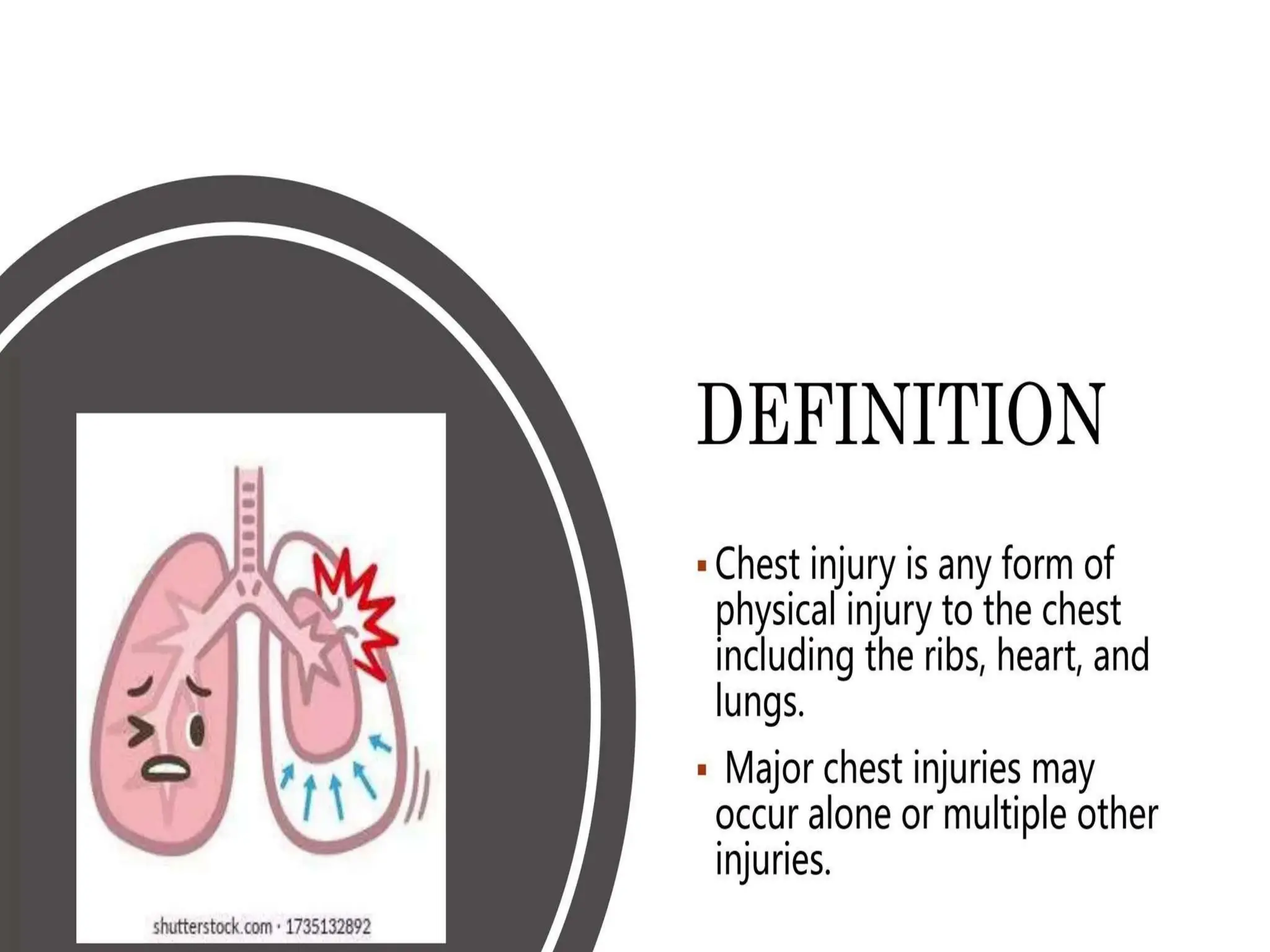 Chest trauma, introduction, summary and results | PPTX