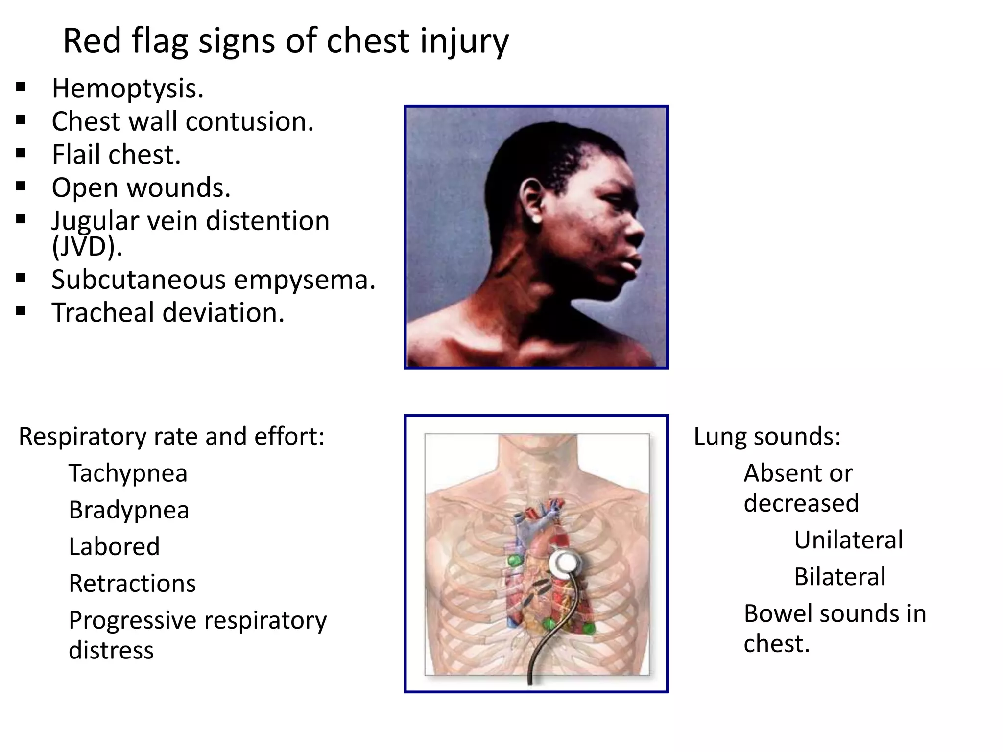 Chest trauma (Emergency Medicine) | PPTX