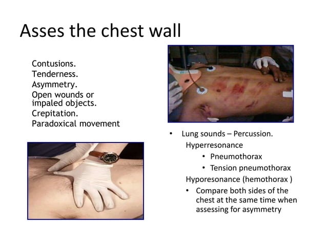 Chest trauma (Emergency Medicine) | PPTX