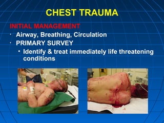 Chest trauma | PPT
