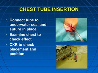 Chest trauma | PPT