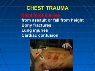 Chest trauma | PPT