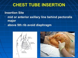 Chest trauma | PPT