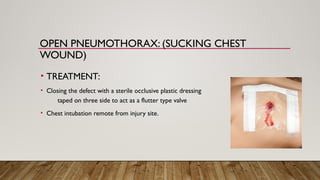 Chest trauma and emergency thoracotomy.pptx