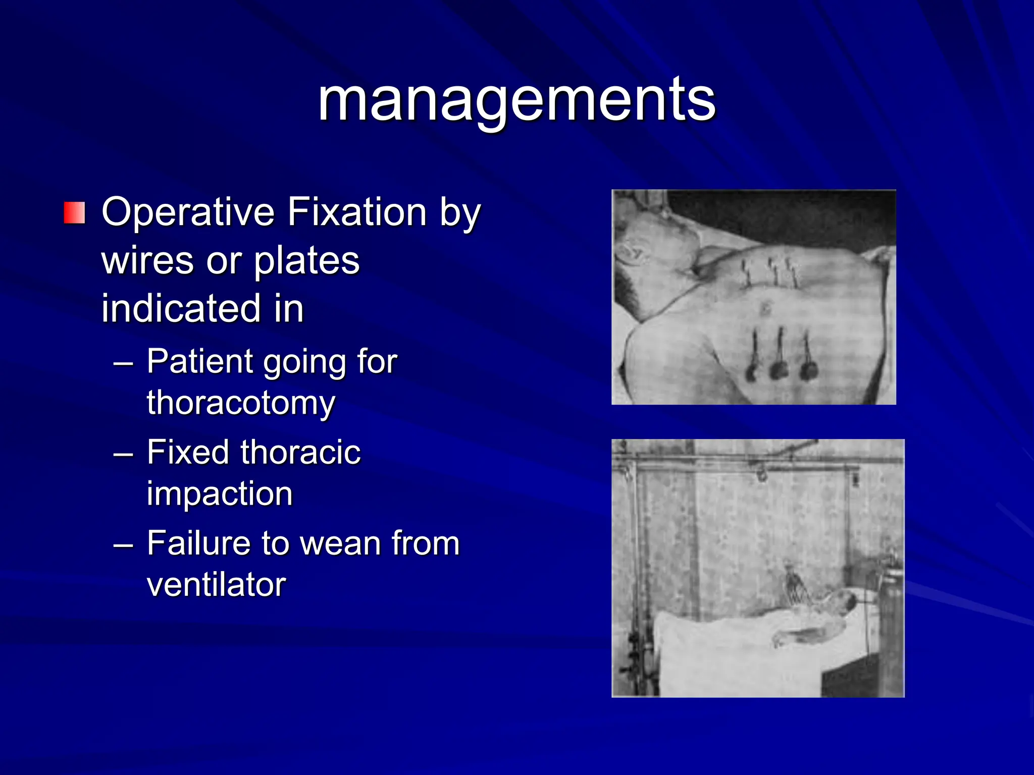 Chest trauma and indication for thoracotomy.ppt