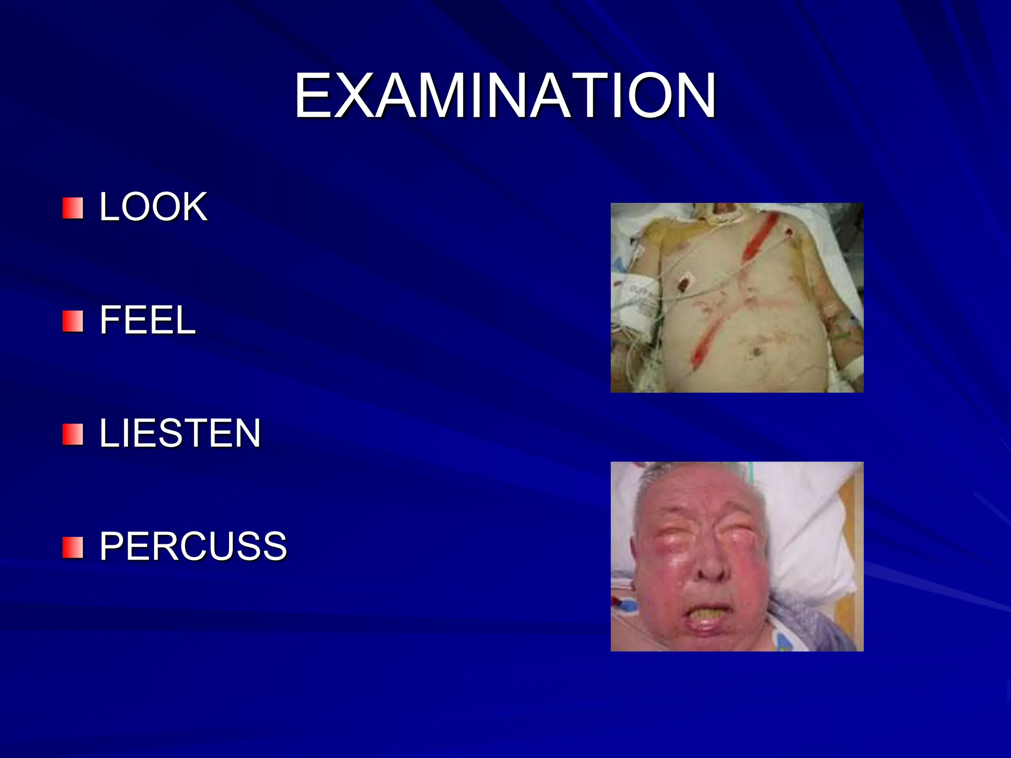 Chest trauma and indication for thoracotomy.ppt