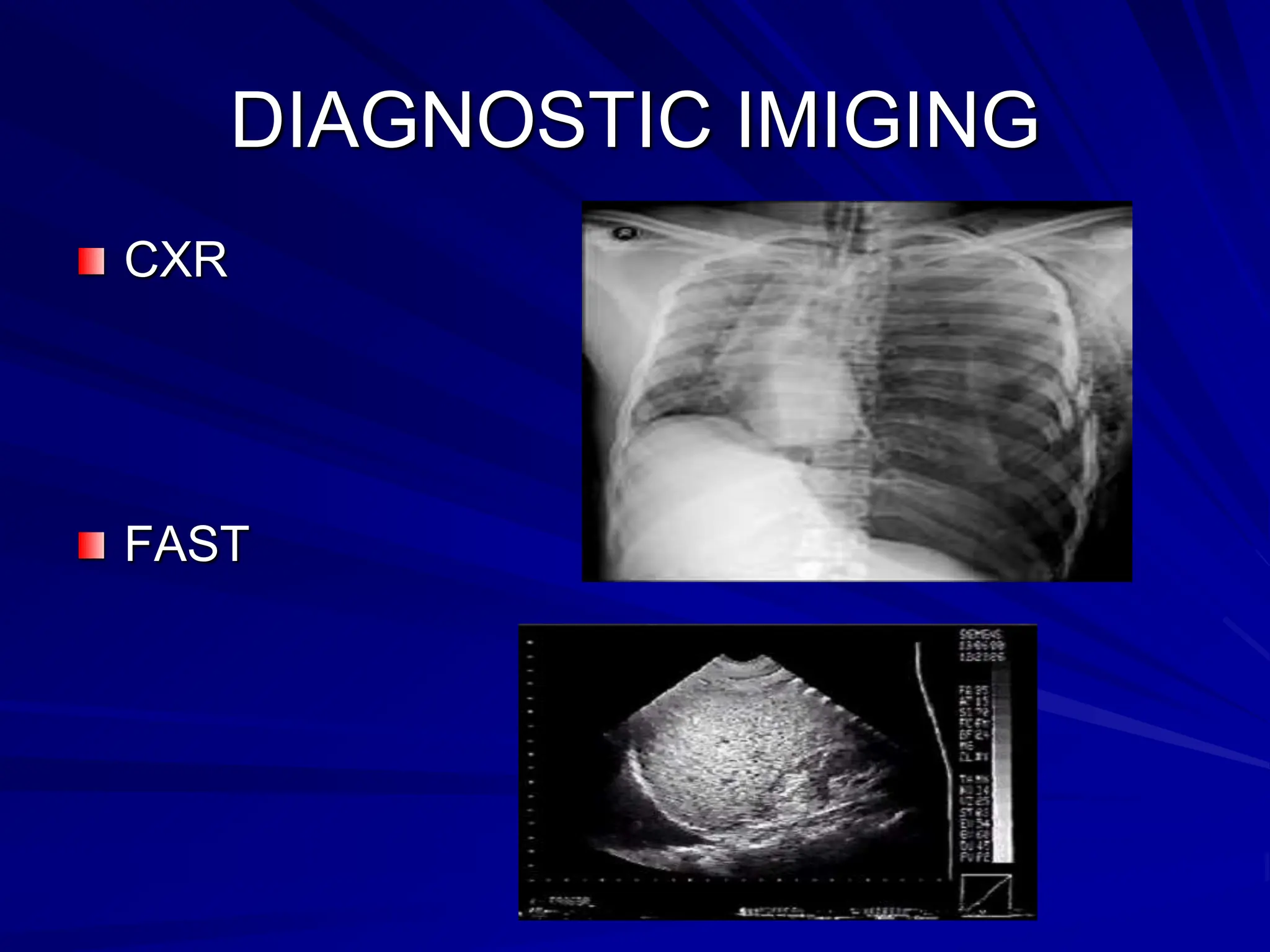 Chest trauma and indication for thoracotomy.ppt