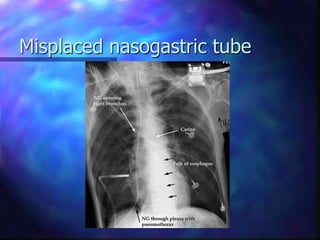chest_trauma ATLS..ppt