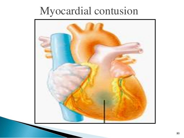 Chest trauma by dr.damodhar.m.v