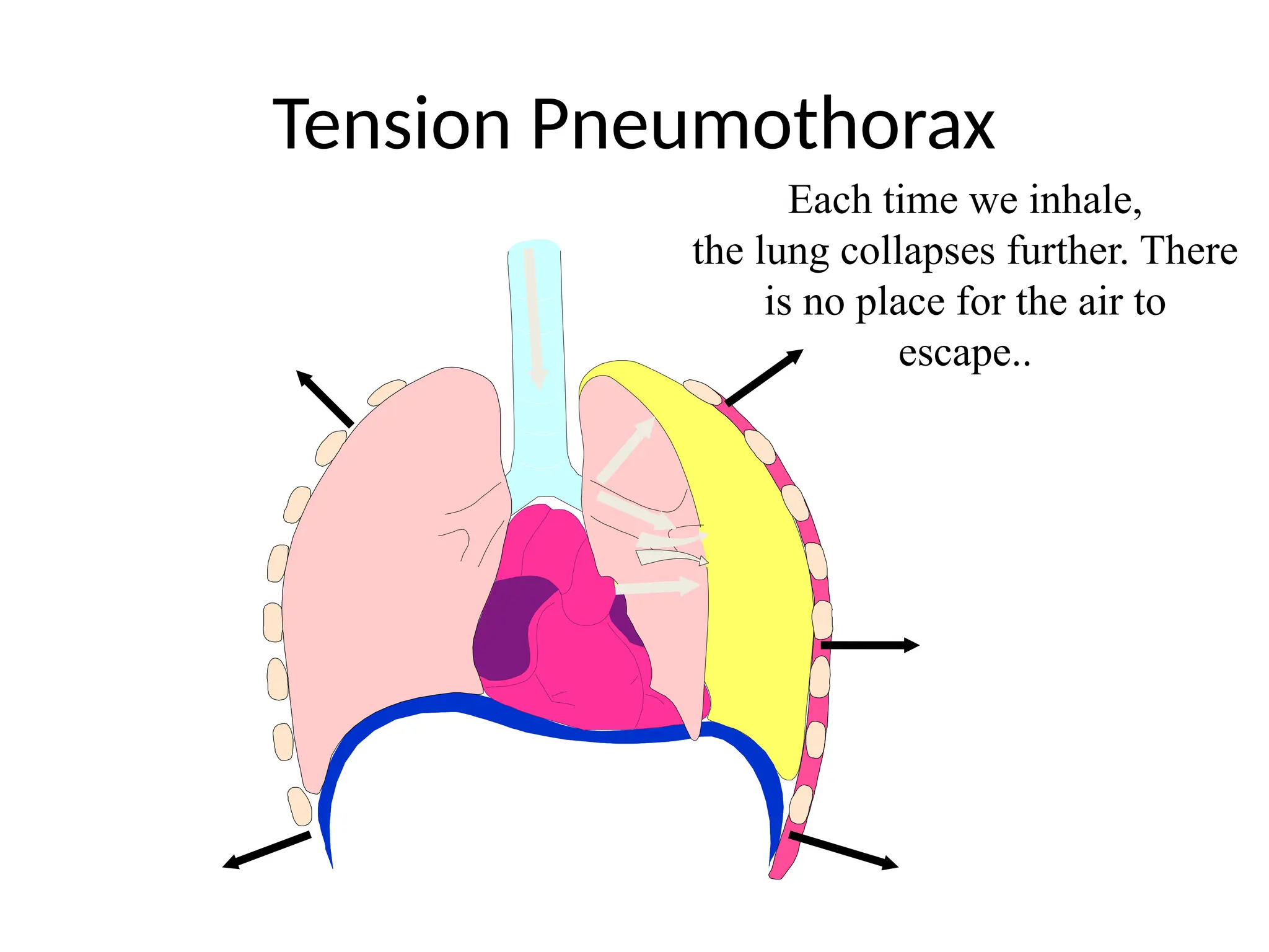 chest_trauma by Dr.Raafat AL-Awadhi.pptx