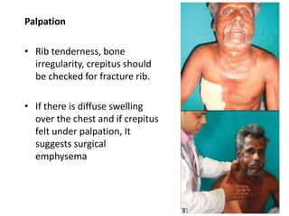 Chest trauma for Nurse.pptx