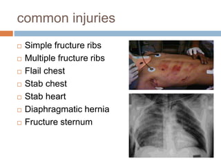 Chest trauma guidelines for ER doctors | PPTX | First Aid | Injuries