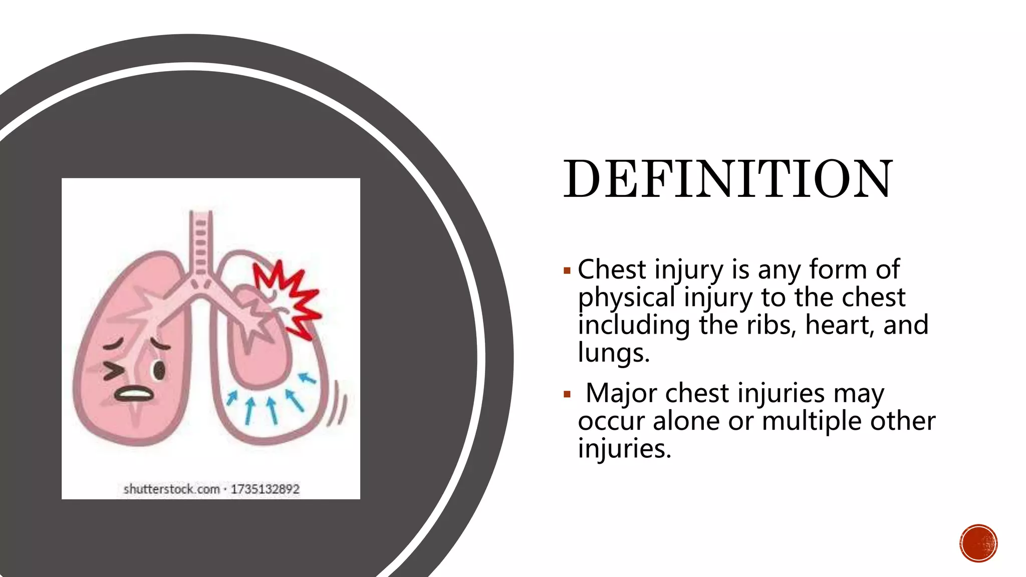 Chest Trauma .pptx