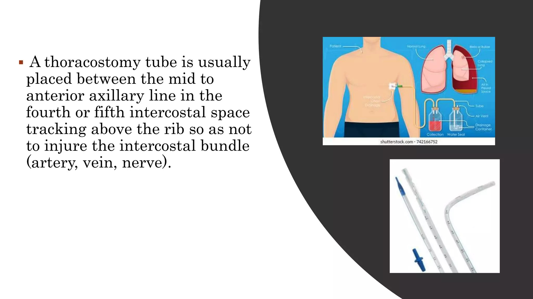 Chest Trauma .pptx