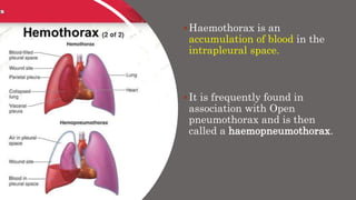 Chest Trauma .pptx