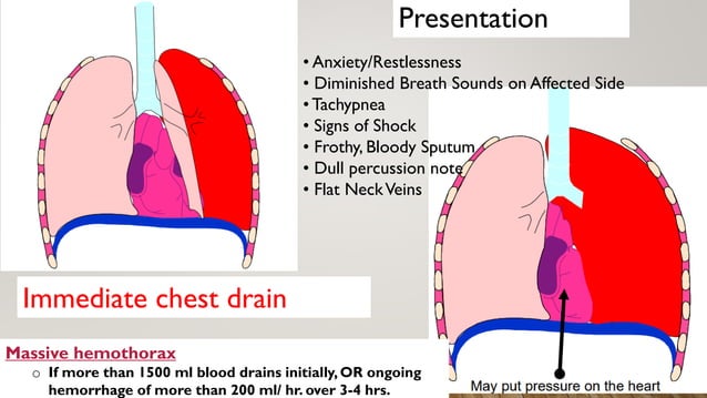 Chest Trauma MBBS teaching in Lilongwe Malawi | PPT