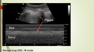 chest trauma ppt 3.0.pptx