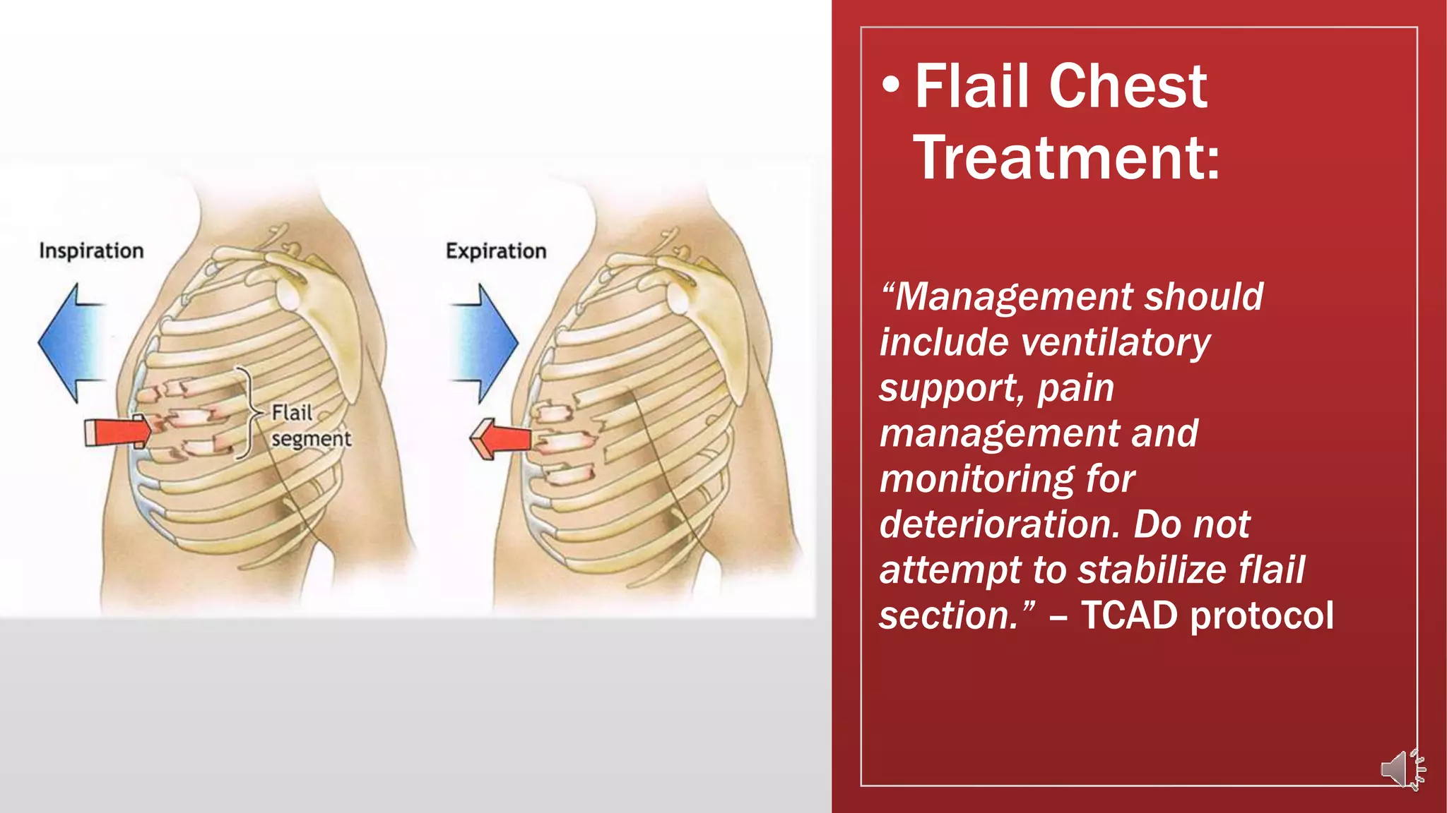Chest trauma ppt for lems | PPTX