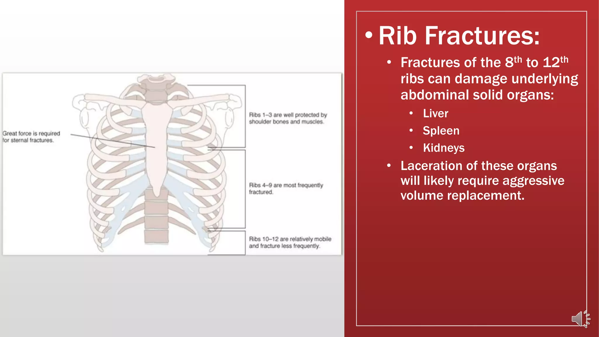 Chest trauma ppt for lems | PPTX