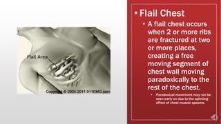 Chest trauma ppt for lems | PPTX