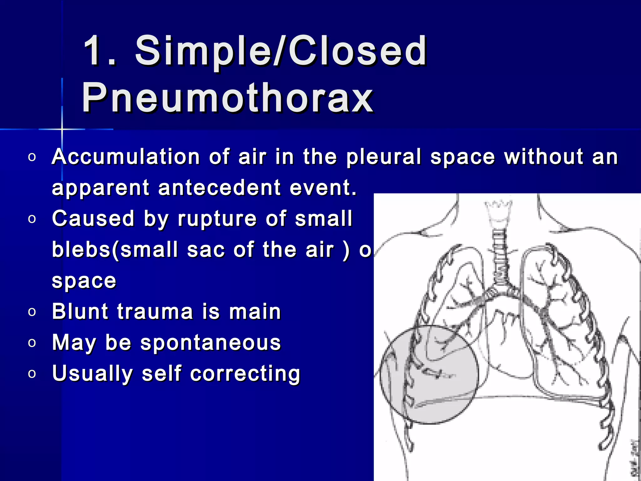 Chest trauma presentation | PPT