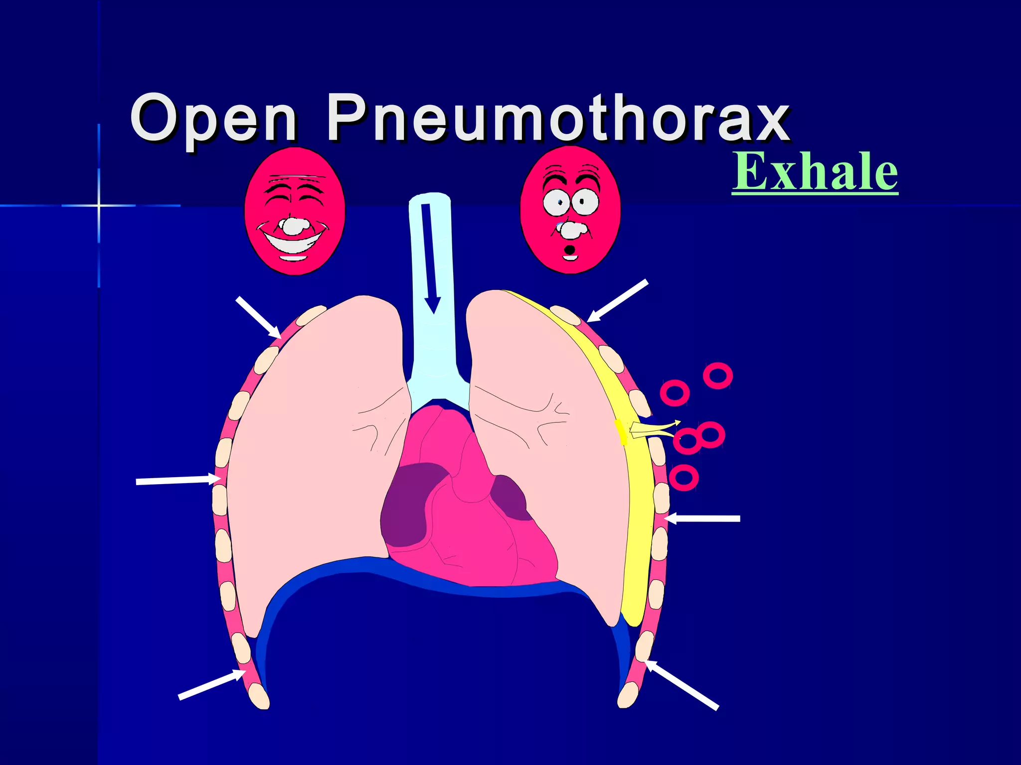 Chest trauma presentation | PPT